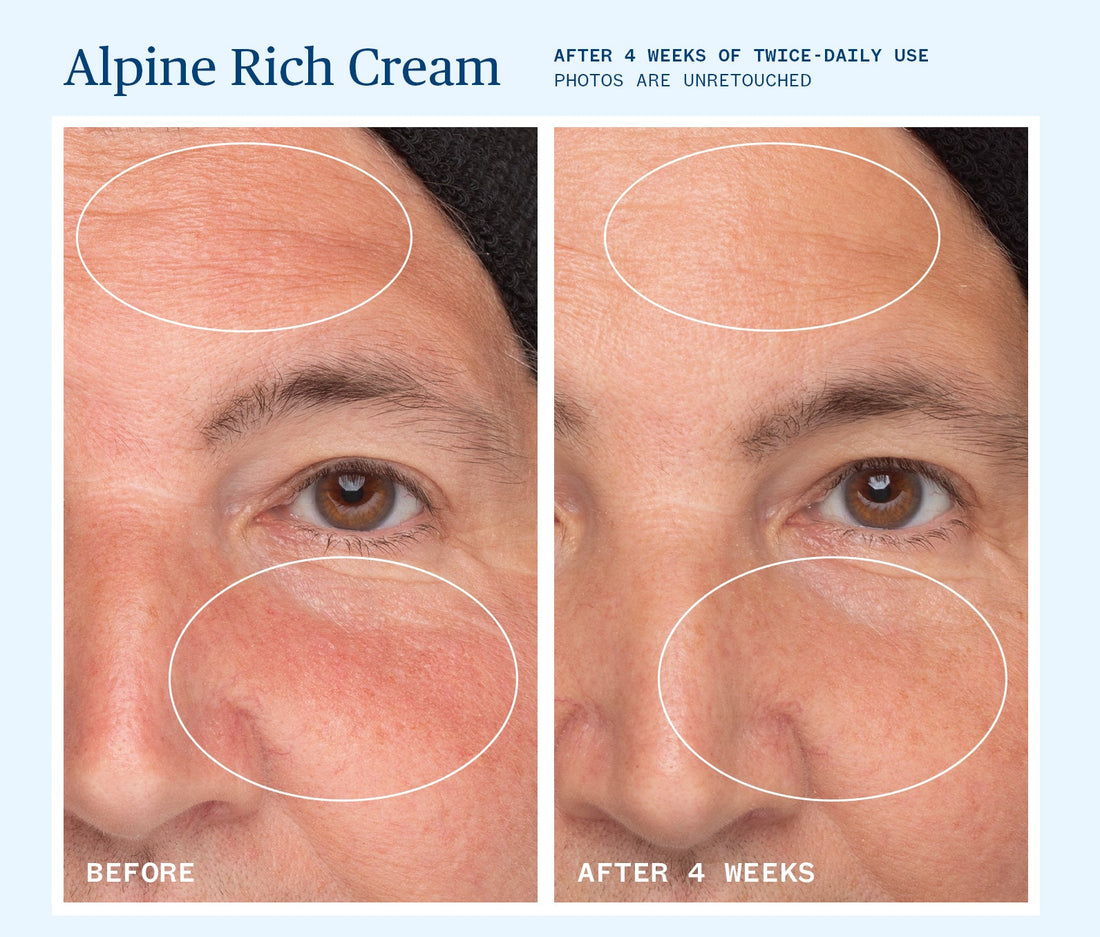 Alpine Rich Cream | Dry Skin's Dream Come True – Ursa Major Skincare